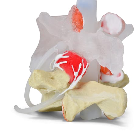 Audible Release Dynamic Disc Model