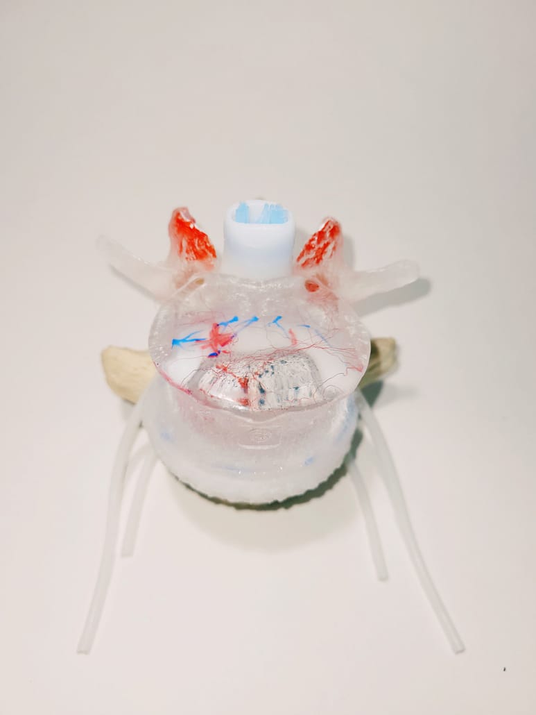 Effects of axial loading on the morphometric and T2 characteristics of ...