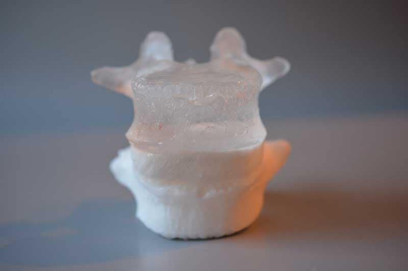 Pediatric Spine Model