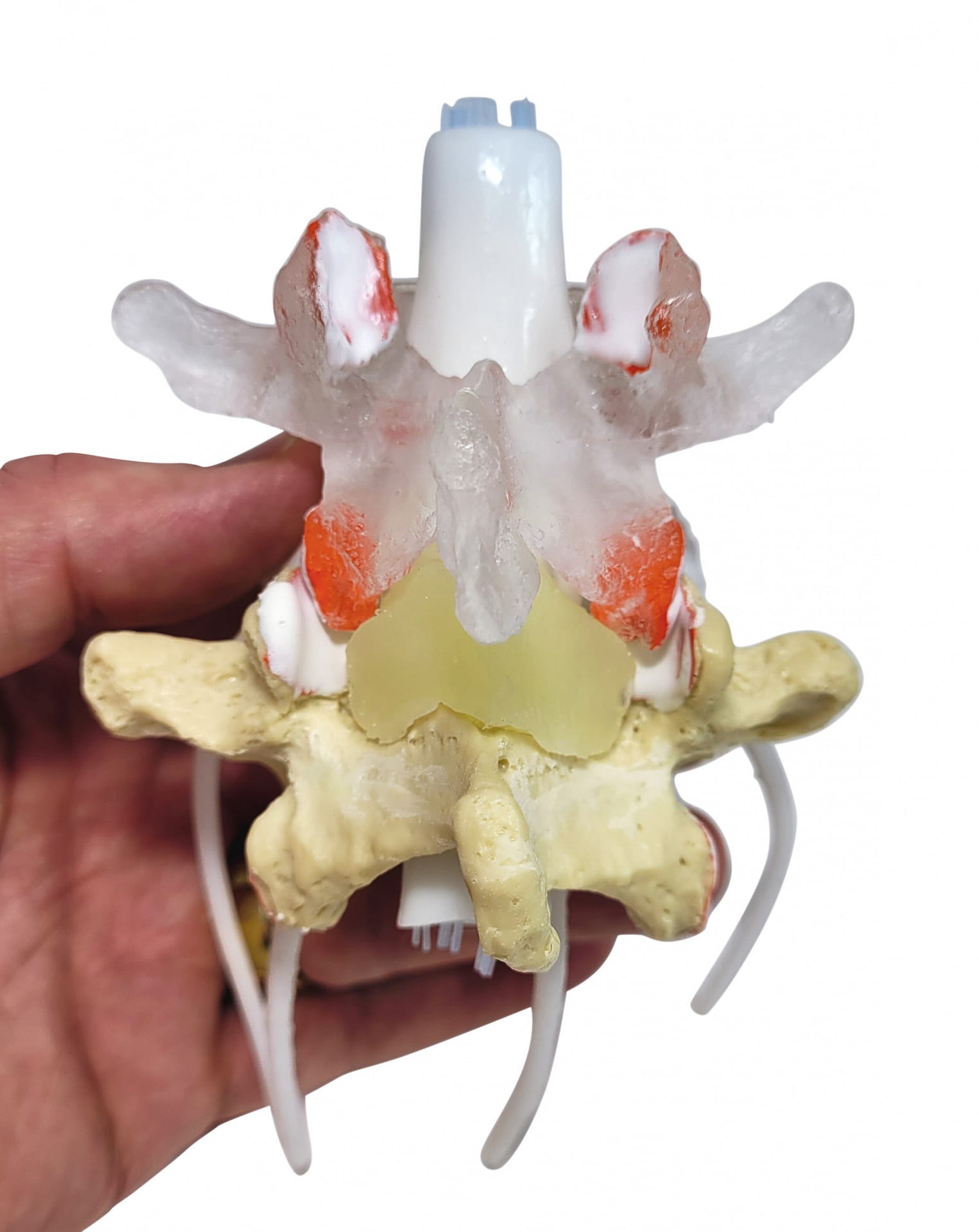 Professional LxH Dynamic Disc Model - Dynamic Disc Designs