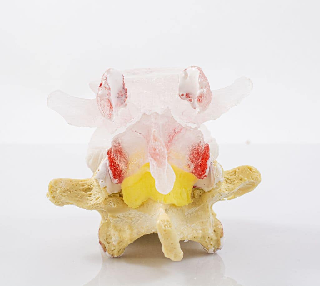 Spine Educator - Dynamic Disc Designs