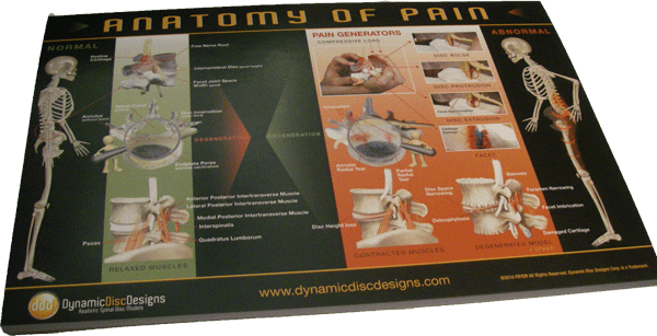 Tear-off Back Pain Mini Poster For Patients - Dynamic Disc Designs