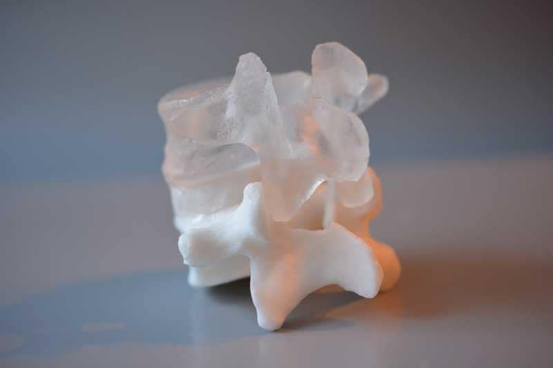 Pediatric Spine Model