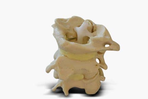 Upper Cervical Model - Dynamic Disc Designs
