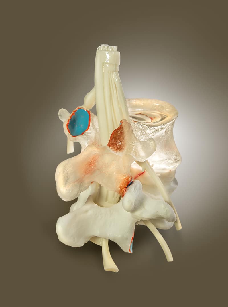 A Selection of Human Spine Models Make Patient Education Easier ...